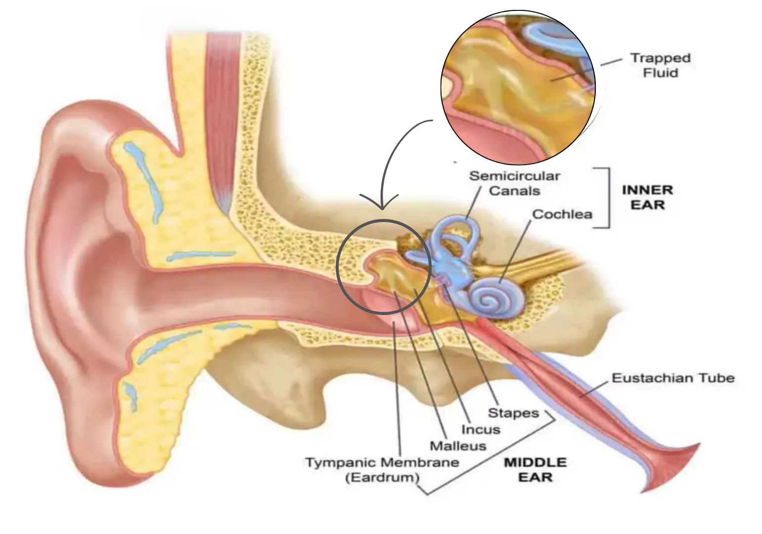 Hearing Aid Program - Clear Hearing